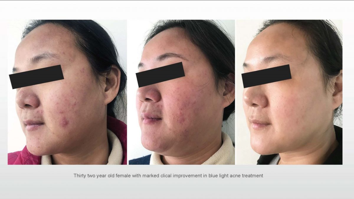 LED Article - MEDISPA SOLUTIONS