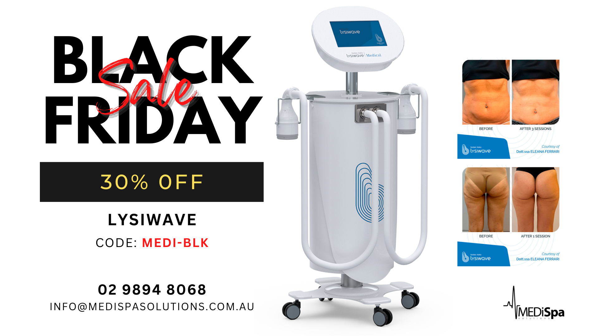 Lysiwave - MEDISPA SOLUTIONS